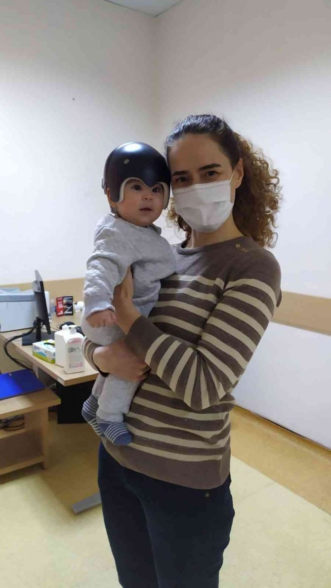 Çocuklarda Kafatası Şekil Bozukluğunda Dikkat Çeken Artış